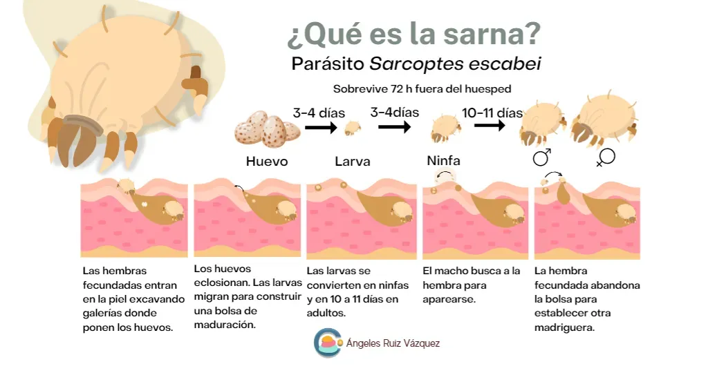 ¿Qué es la sarna y cómo se contagia? Confirman brote en cuarta región