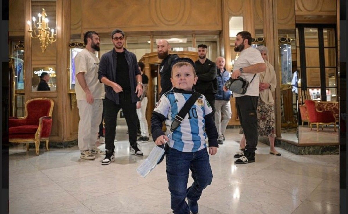 ¿Qué enfermedad tiene Hasbulla? - Bolavip Argentina