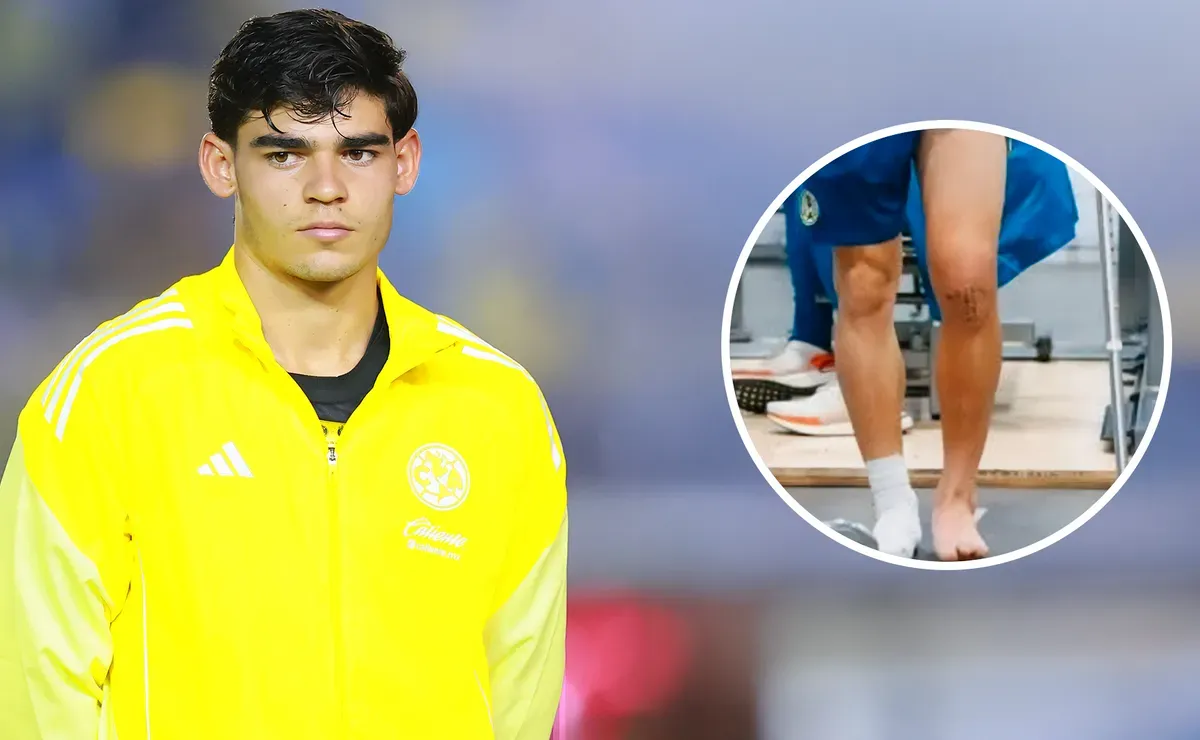 Dagoberto Espinoza y su brutal cicatriz por su lesión con el Club América