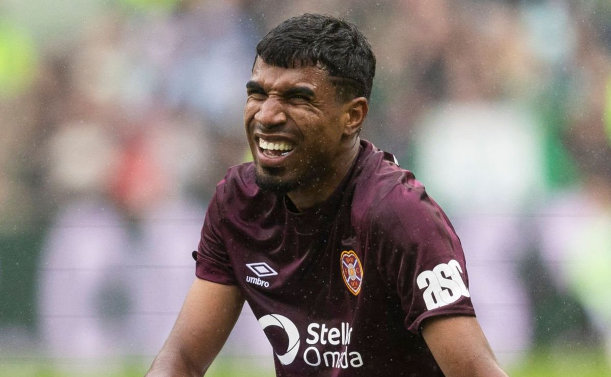 En muletas: lesión de Gerald Taylor despierta preocupación en Escocia y ...