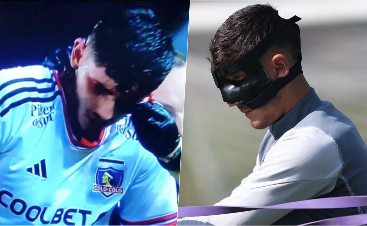 Bruno Gutiérrez reaparece enmascarado tras duro golpe contra Monagas